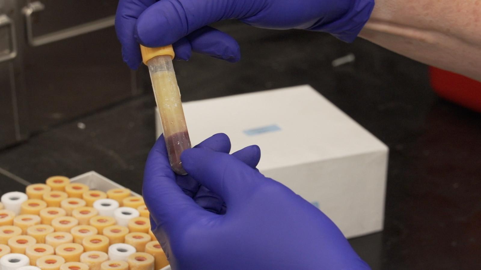 The Kentucky Research Registry and Specimen Bank: Patient Q&A | UK Research